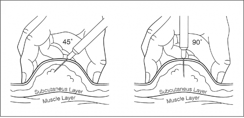 Subcutaneous Injection