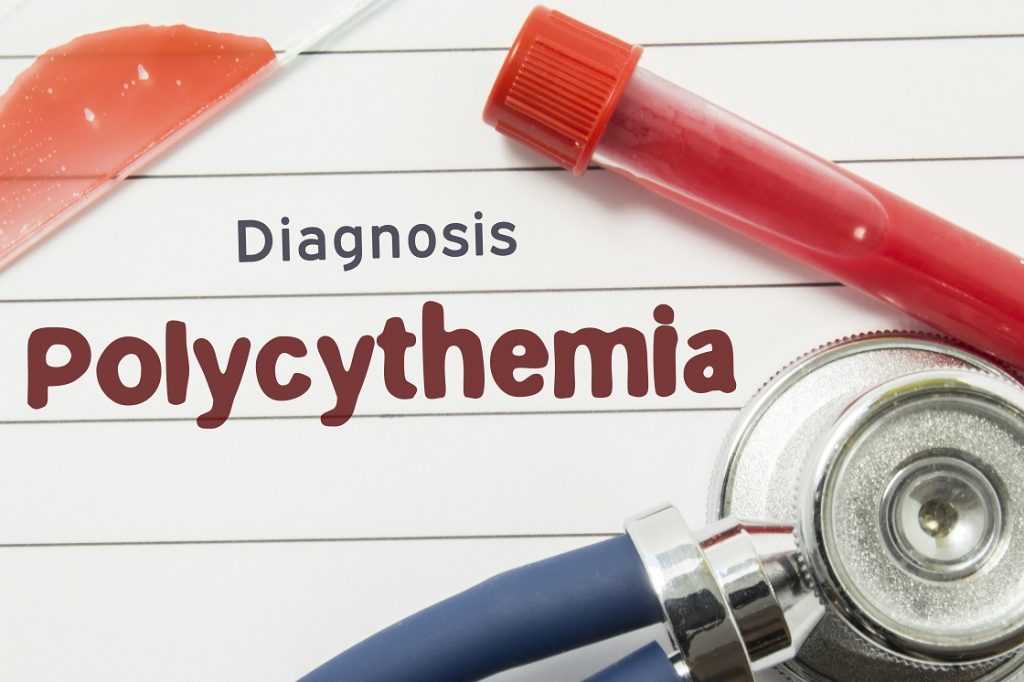 How to Manage Polycythemia Caused by Testosterone Replacement Therapy (TRT)