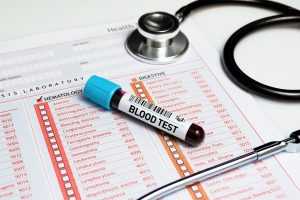How to Manage Polycythemia Caused by Testosterone Replacement Therapy (TRT)