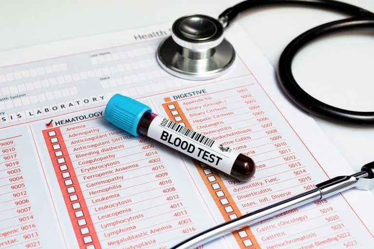 How to Manage Polycythemia Caused by Testosterone Replacement Therapy (TRT)