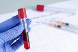 Navigating Male Hormonal Imbalances: Understanding High and Low FSH and ...