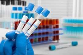 Mastering Hematocrit Levels: A Comprehensive Guide for Men