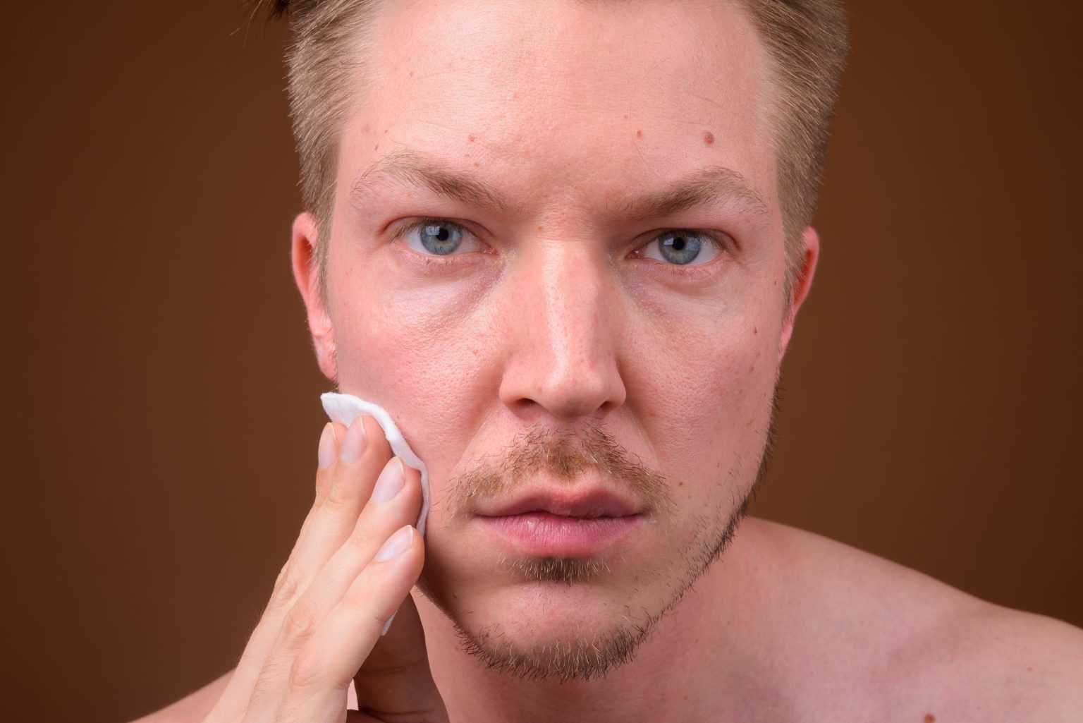 The Impact of Testosterone Replacement Therapy on Skin Health: Oily ...