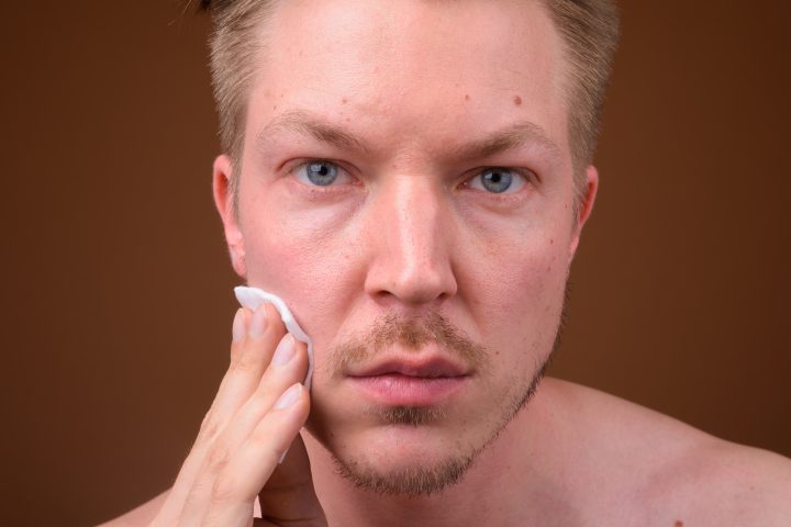 The Impact of Testosterone Replacement Therapy on Skin Health: Oily ...