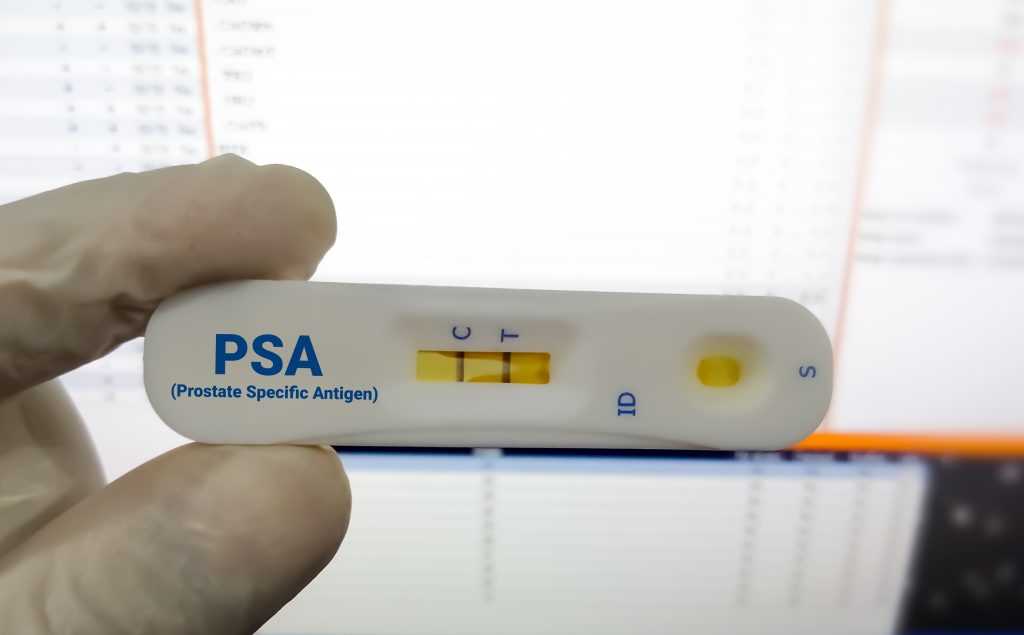 TRT and Elevated PSA: What You Need to Know About Testosterone Therapy ...