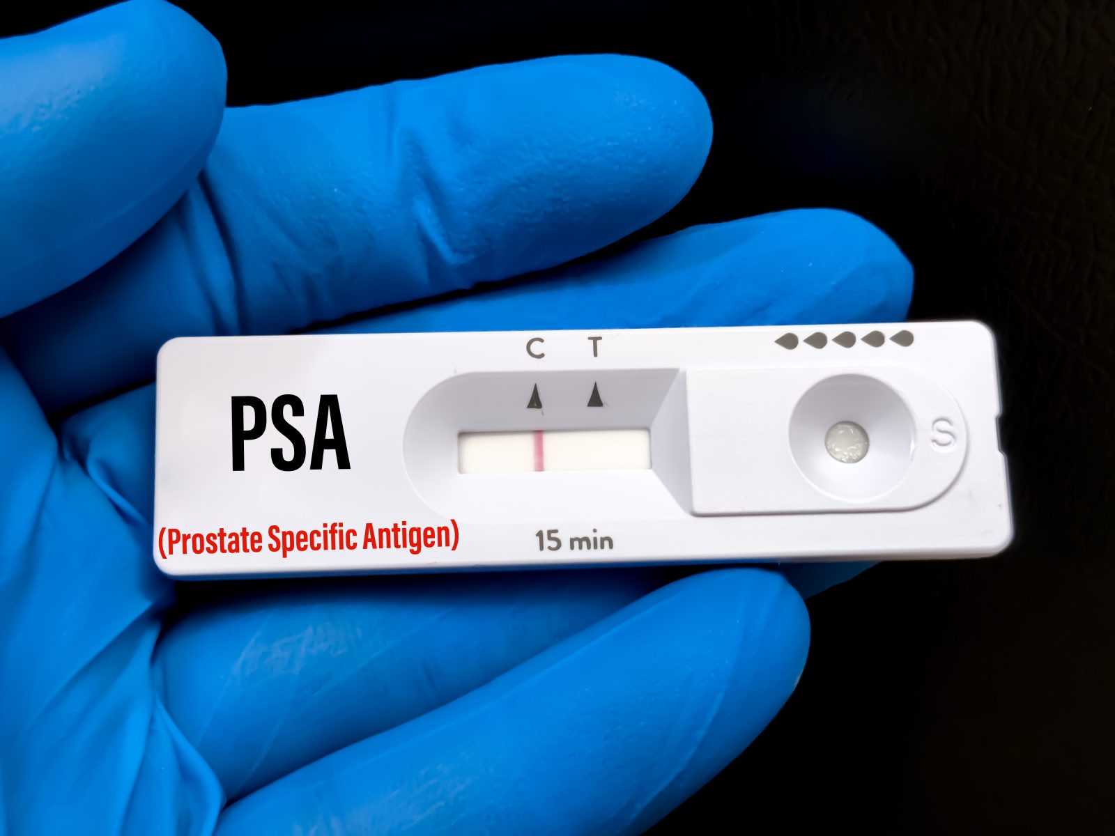 TRT and Elevated PSA: What You Need to Know About Testosterone Therapy ...