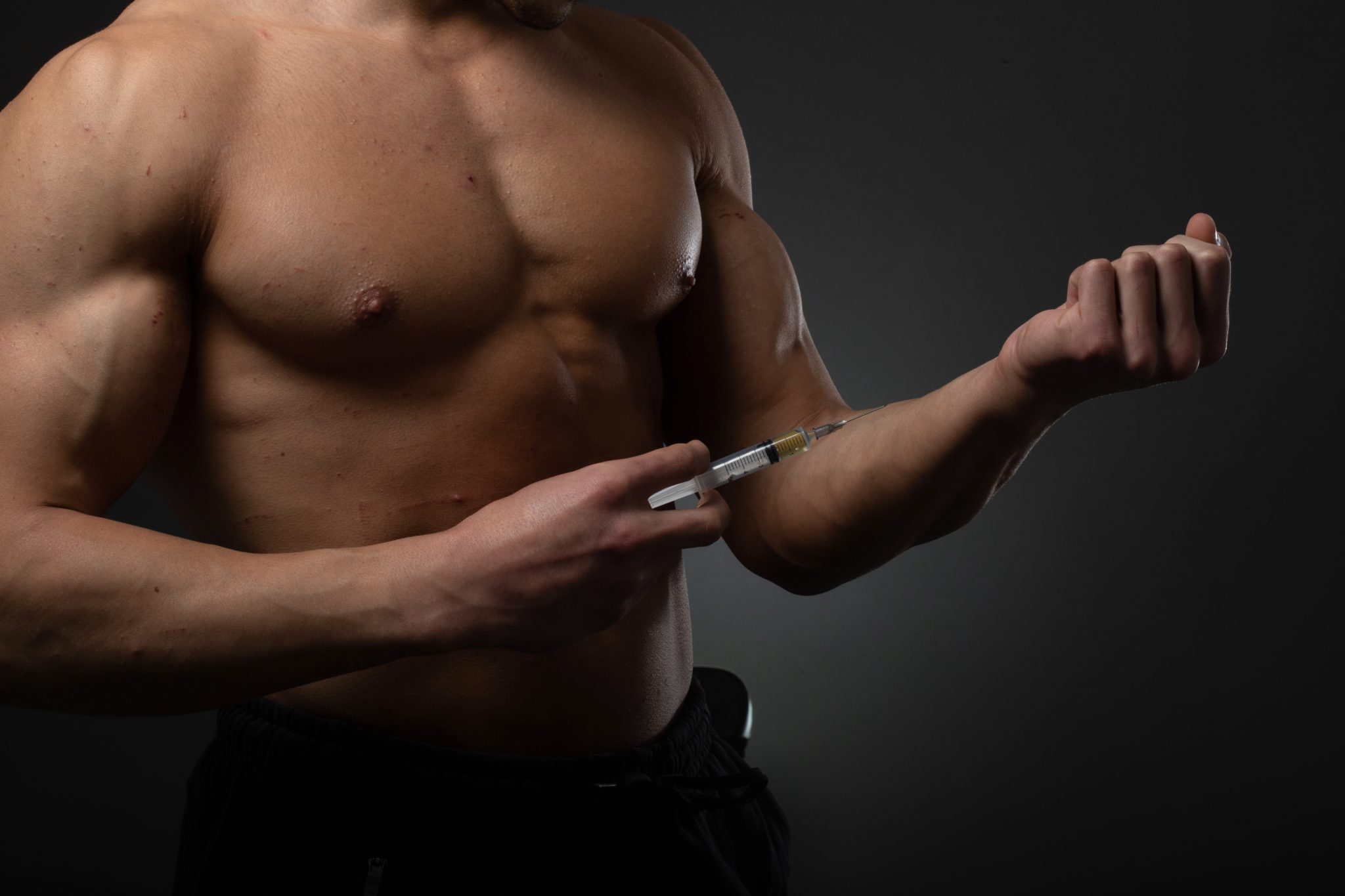 TRT vs. Steroids Explained: Which Is Right for You