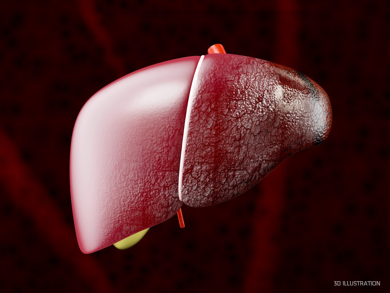 How TRT Affects Liver Health: Insights Into Liver Enzyme Changes