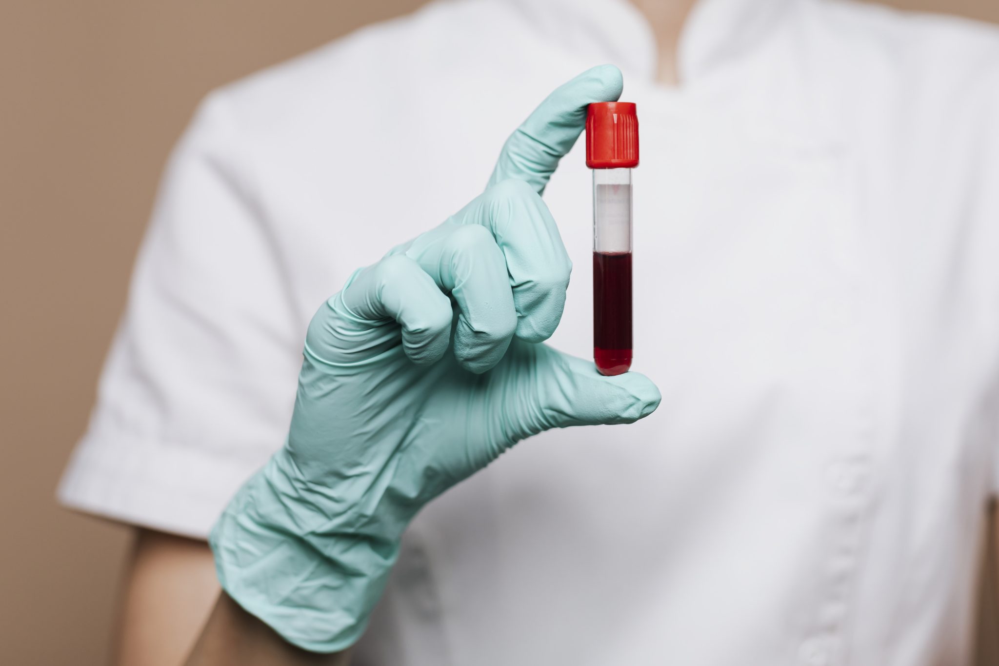 Low T Protein Blood Test: The Silent Signal Your Body Wants You to Notice