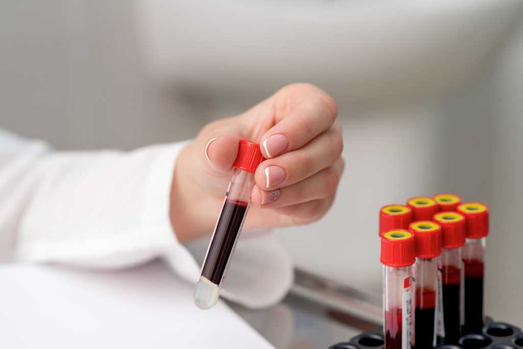 Low T Protein Blood Test: The Silent Signal Your Body Wants You to Notice