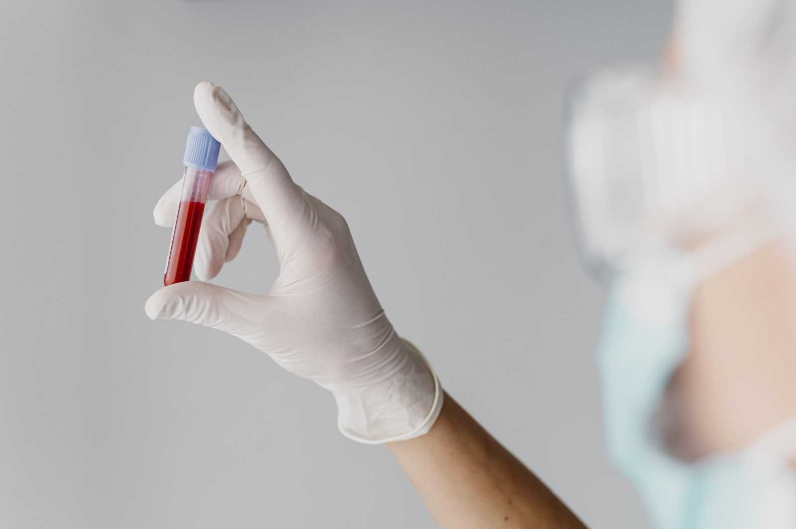 How Testosterone Replacement Therapy Affects Hematocrit Levels: A ...