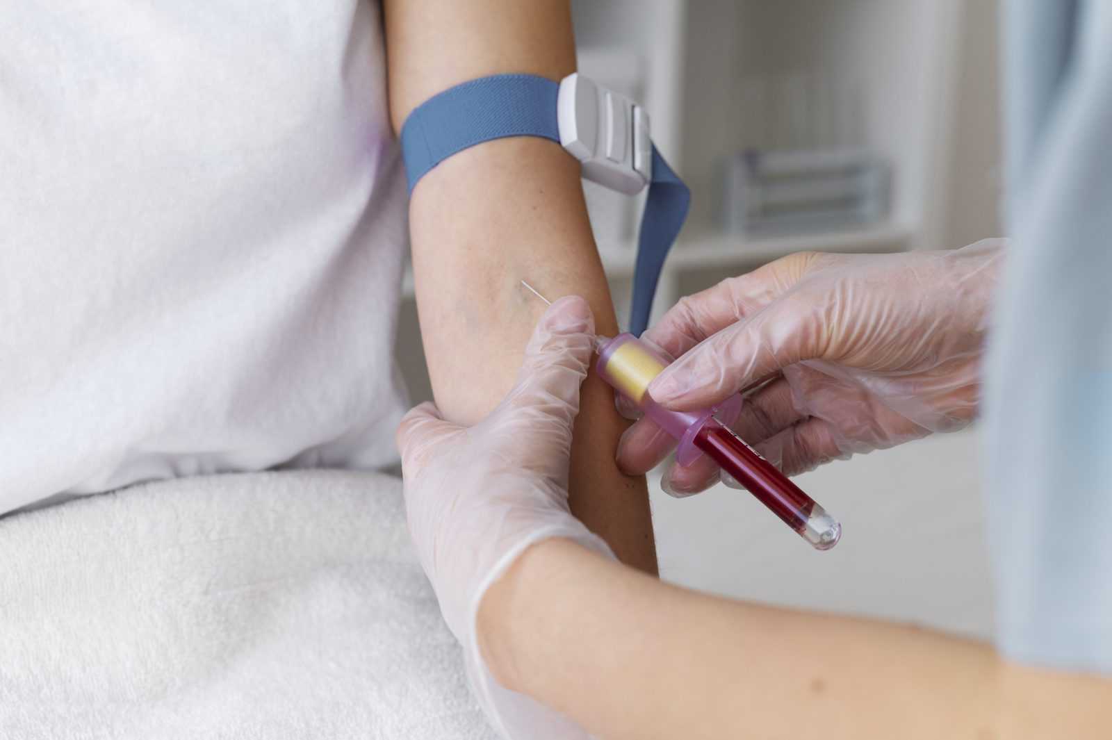 How Testosterone Replacement Therapy Affects Hematocrit Levels: A ...