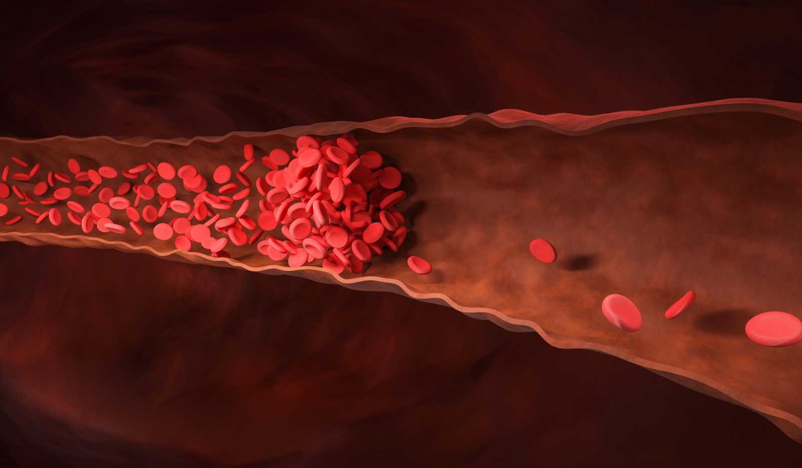 Understanding the Link Between Testosterone Replacement Therapy and ...
