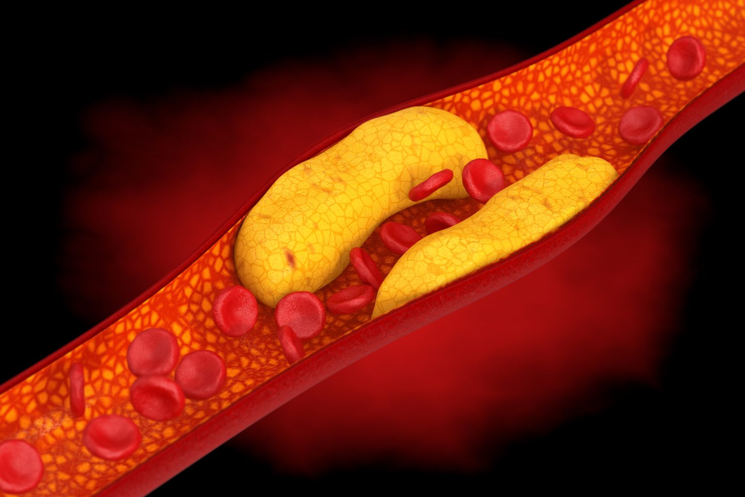 TRT and Cholesterol: How Testosterone Therapy Really Affects Your Heart ...
